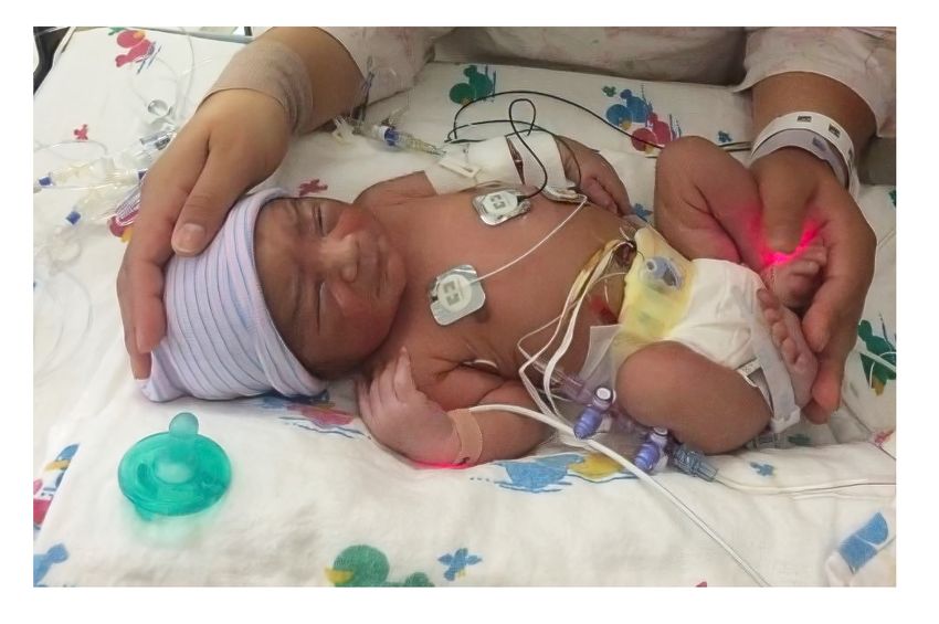 Photo | Baby Jacob | American Heart Association