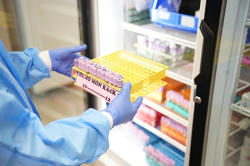 Photo | Blood vials stored in the lab | American Heart Association