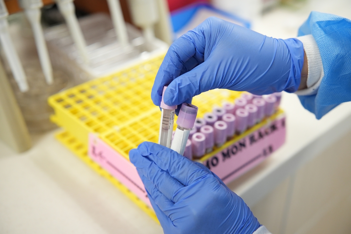 Photo | Lab tech with mutliple vials | American Heart Association