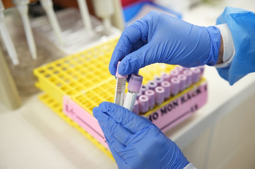 Photo | Lab tech with mutliple vials | American Heart Association