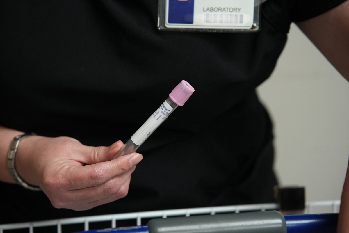 Photo | Lab tech with vial | American Heart Association