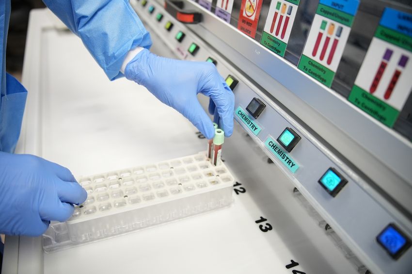 Photo | Placing vials in container | American Heart Association