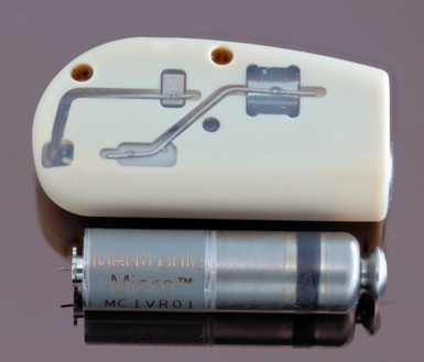 Photo | pediatric pacemaker | American Heart Association
