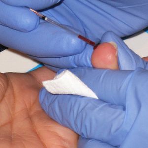 CVD & Stroke Risk Factors (tests) | American Heart Association