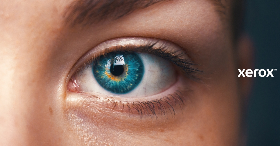 PARC, a Xerox Company, Signs Agreement with Alcon on New Eye Care ...