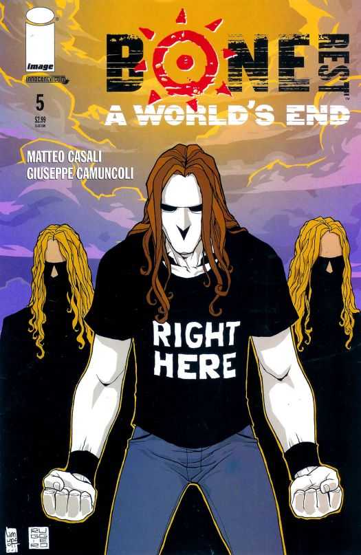 Bone Rest #5 Reviews