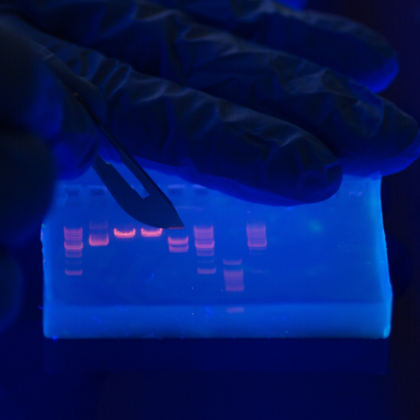How to Interpret DNA Gel Electrophoresis Results | GoldBio
