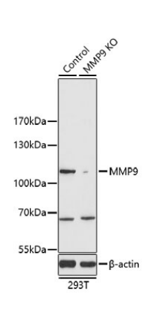 An Introduction to Primary Antibodies and Secondary Antibodies | GoldBio