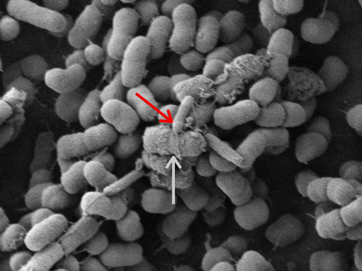 How Predatory Bacteria Could Help Us Defeat Harmful Bacteria | GoldBio