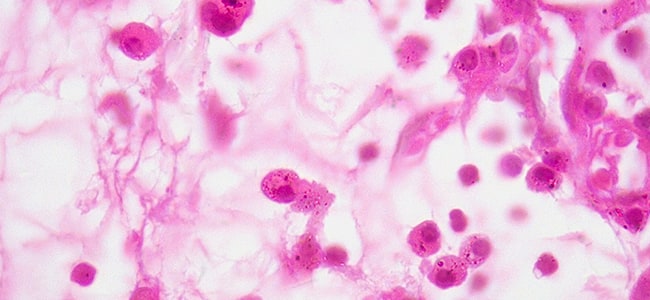 What is Plasma? :: ADMA BioCenters