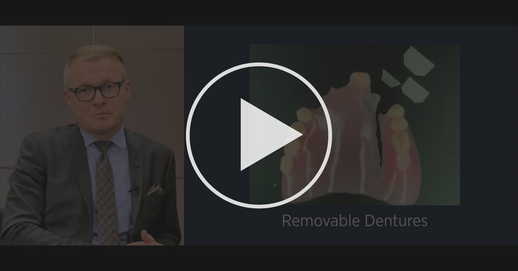 Applications of Fibre-Reinforced Composite (FRC) in Dentistry - Modern ...