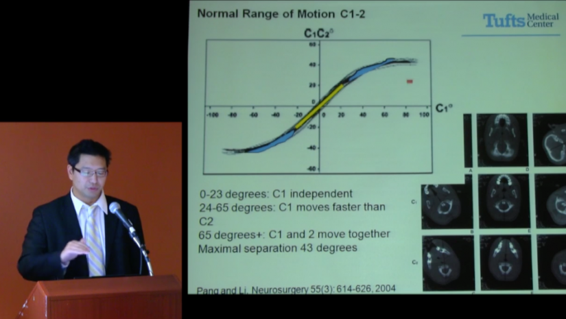 Atlanto-Axial Instability – Bobby Jones CSF