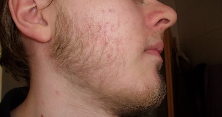 No-Shave November: The Complete Beard Styling Guide