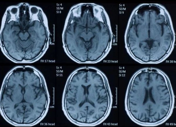 BASIC MRI PART 2 | DC Hours