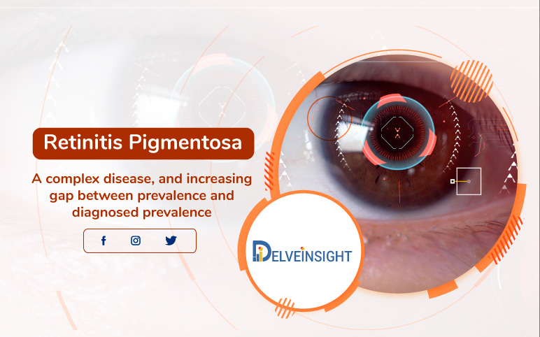 Retinitis Pigmentosa Epidemiology Forecast | Delveinsight
