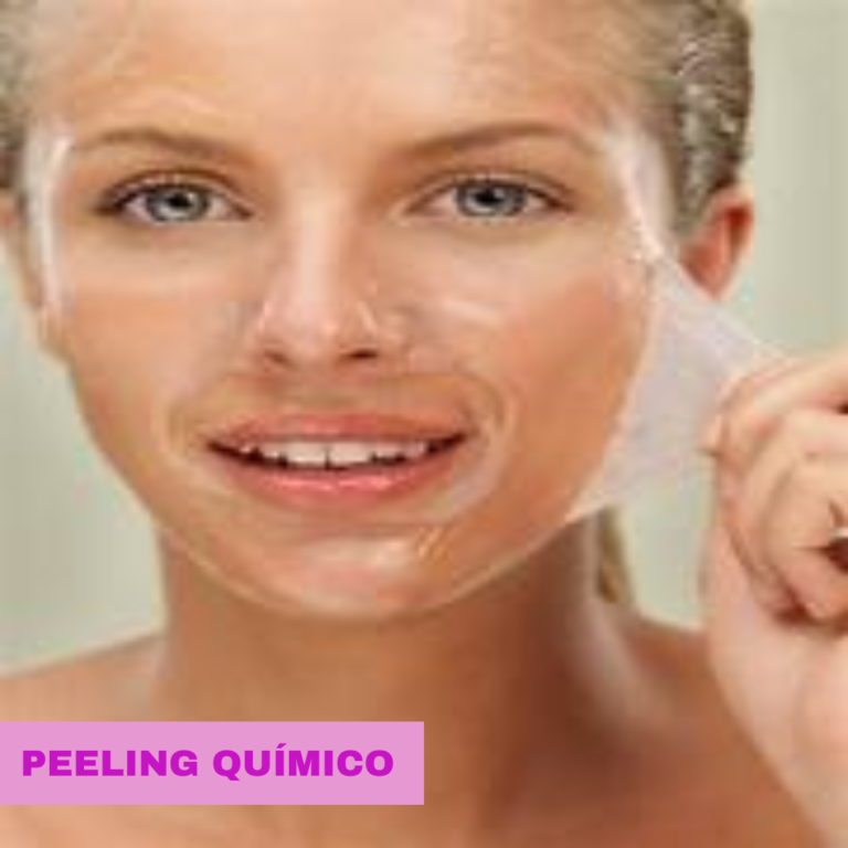 PEELING QUÍMICO - Spazzio