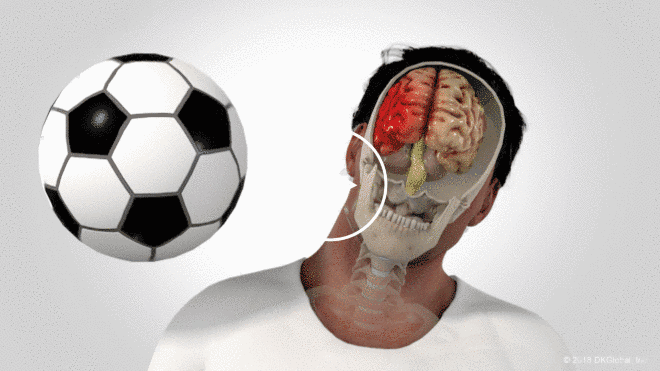 DK Global | Case Feature | Man Sustains Traumatic Brain Injury At ...