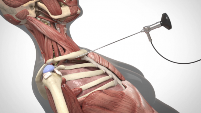 DK Global | Case Feature | Visuals Show Permanent Injuries from Severe ...