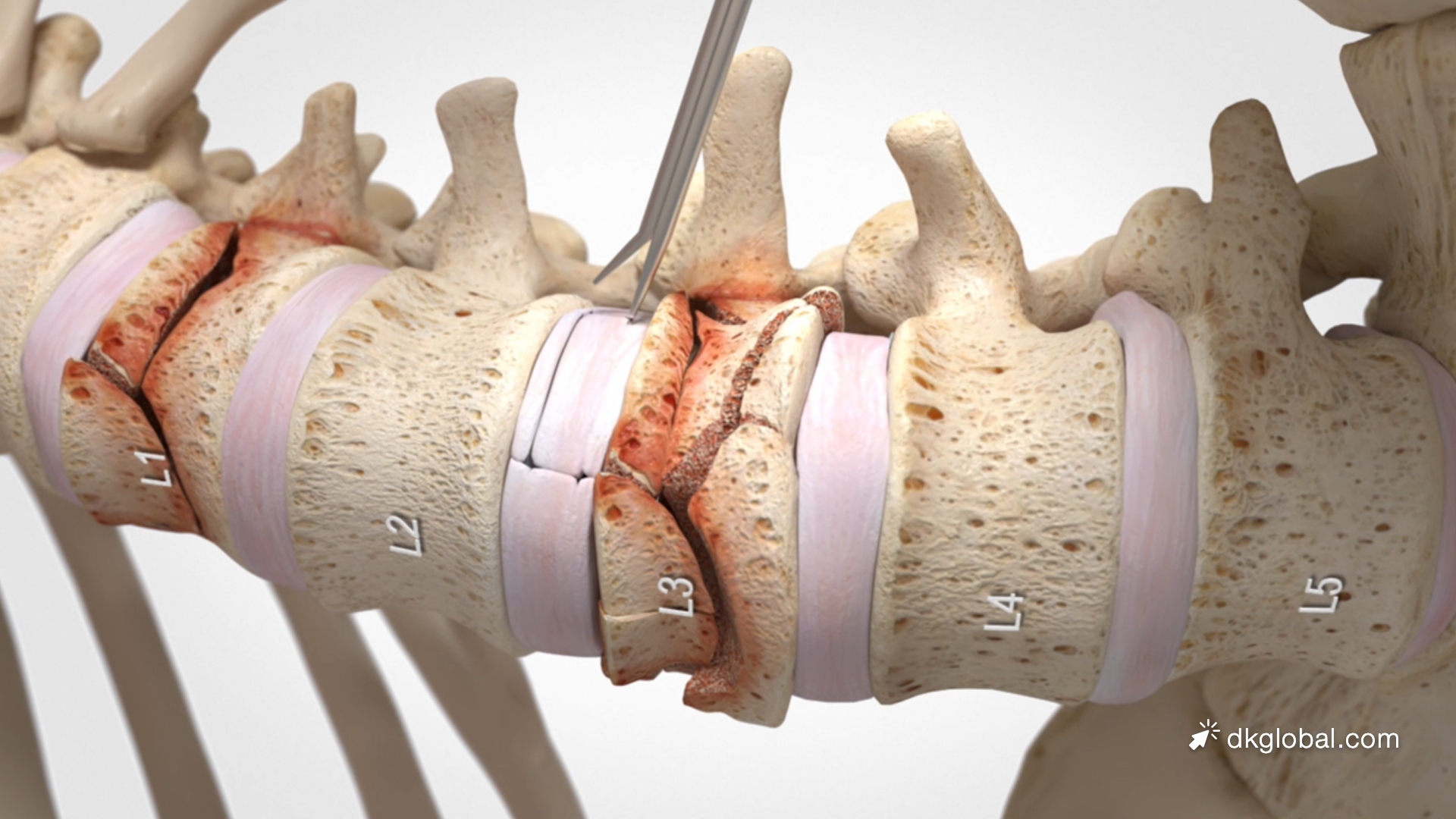 DK Global | Case Feature | Behind the Visuals: The Impact of Surgical ...