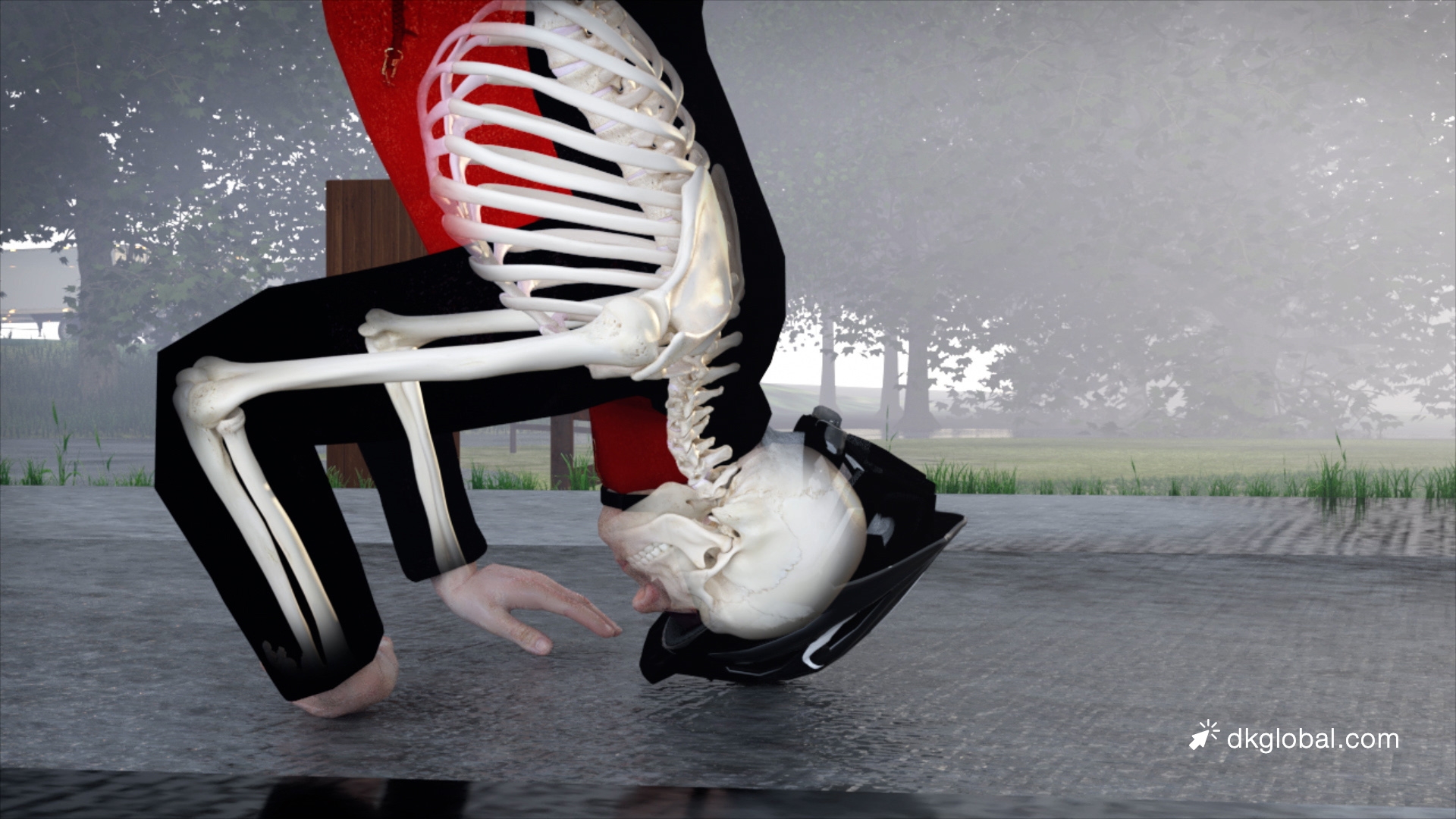 DK Global | Case Feature | $10M Settlement After Cyclist Breaks Neck on ...