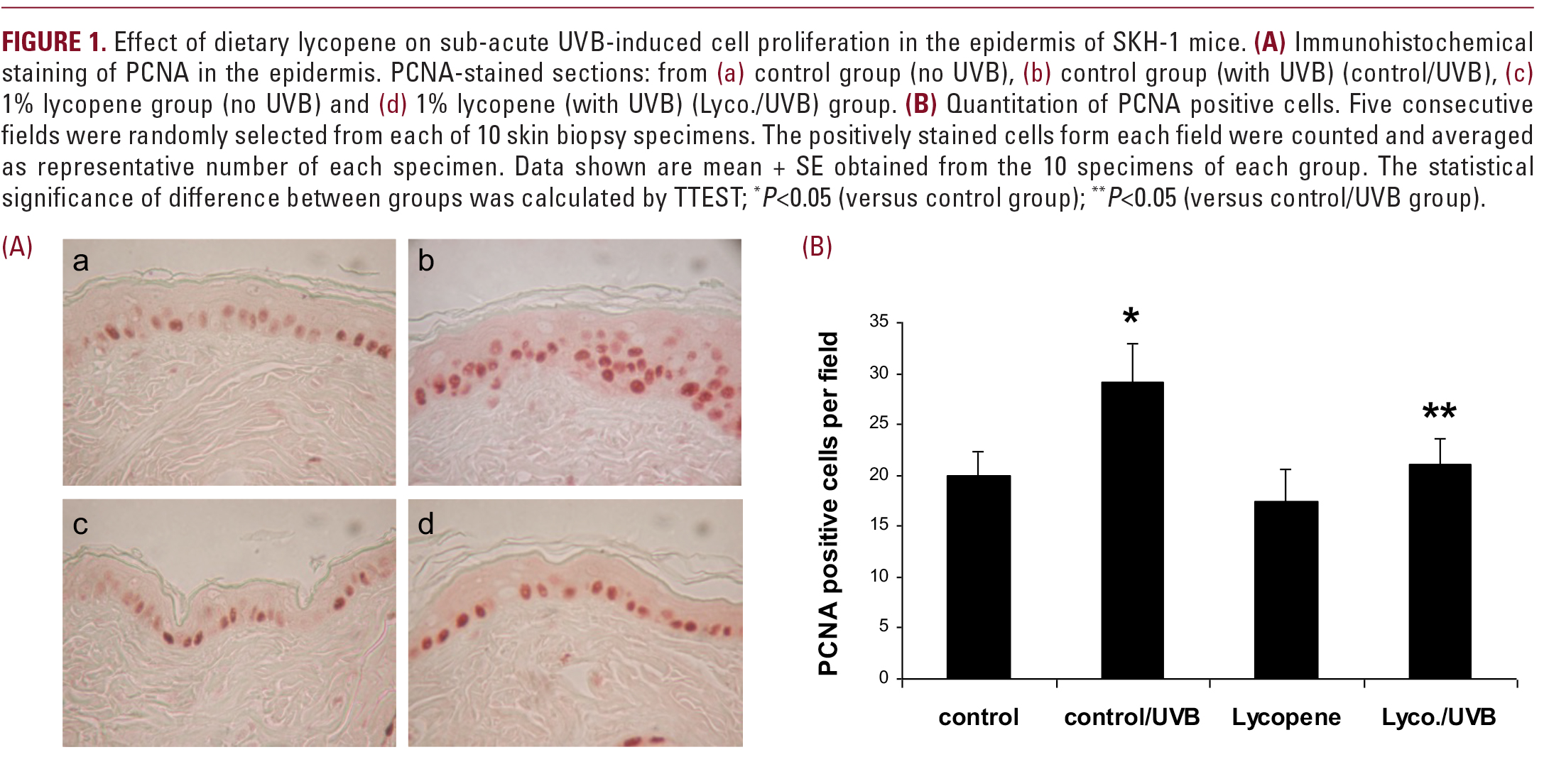 Dietary Lycopene Protects SKH-1 Mice Against Ultraviolet B-Induced ...