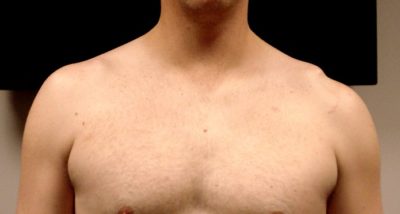 AC Separation | Dr Christopher S Ahmad