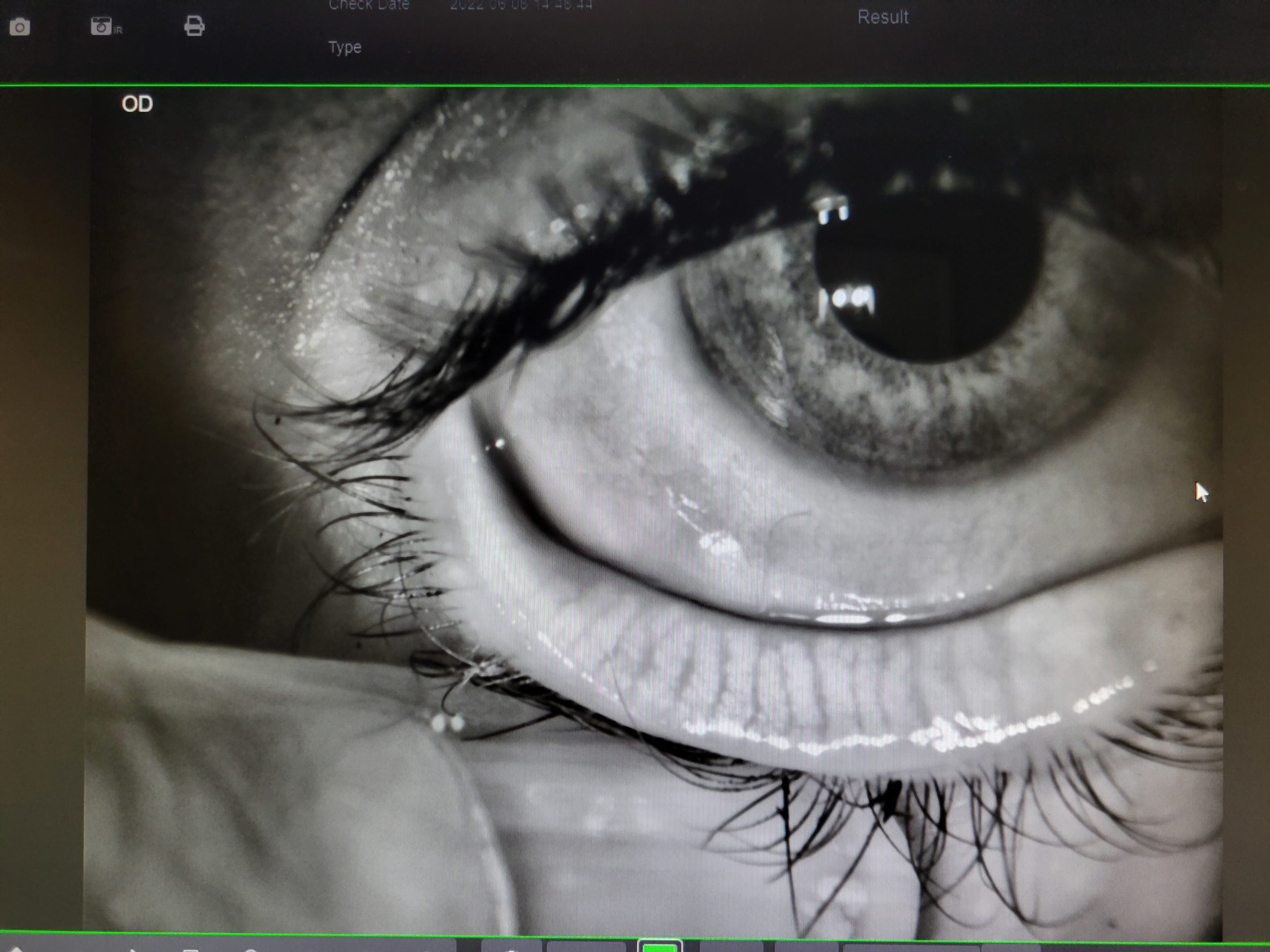 Firefly Digital Slit Lamp | Clayton Heights Optometry