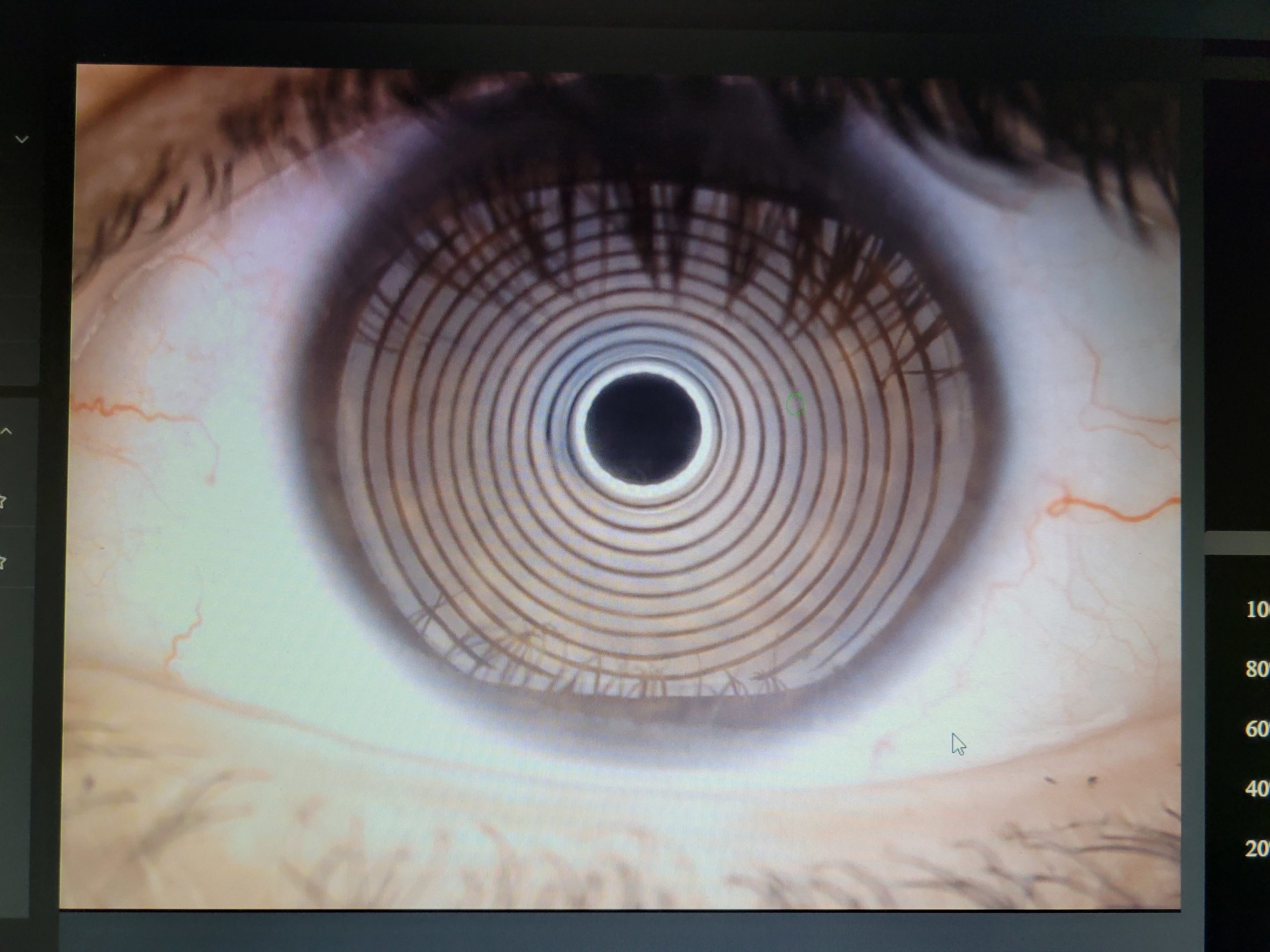 Firefly Digital Slit Lamp | Clayton Heights Optometry