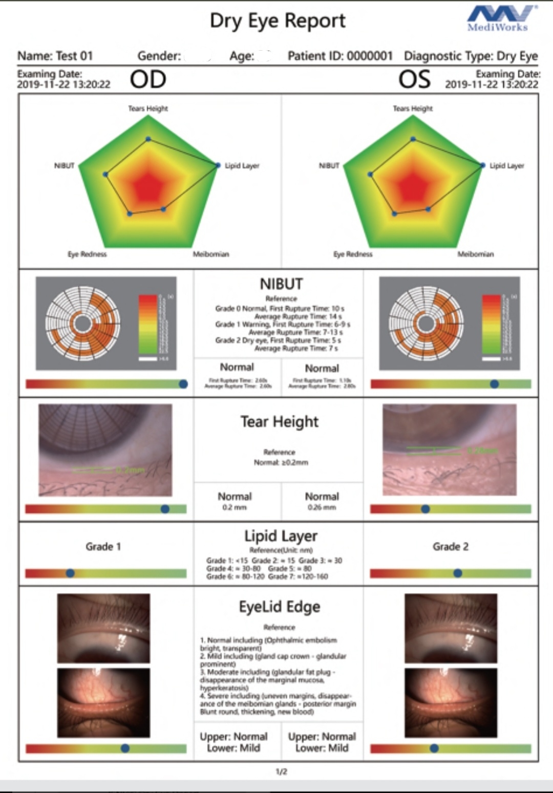 Firefly Digital Slit Lamp | Clayton Heights Optometry