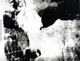 Questions and Answers with Our Vision Therapist Doctor