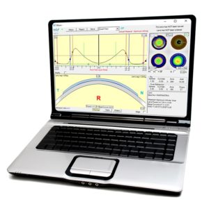 Wave Custom Night Lens Orthokeratology