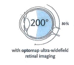 Optomap Consent | Orange County Eyecare Optometry