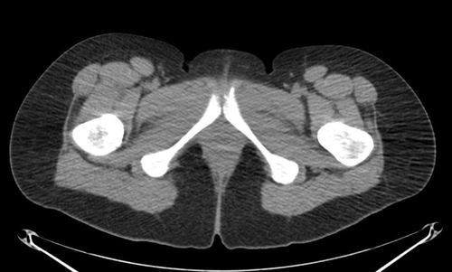 CT scan DICOM files for instructables tutorial - Tutorials - embodi3D.com