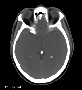 Head and Neck CT DICOM dataset for teaching - Spine CTs - embodi3D.com