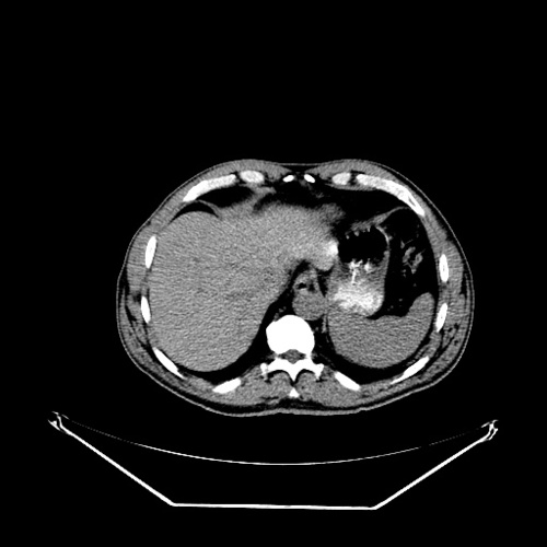My first experience with DICOM - Whole Body CTs - embodi3D.com