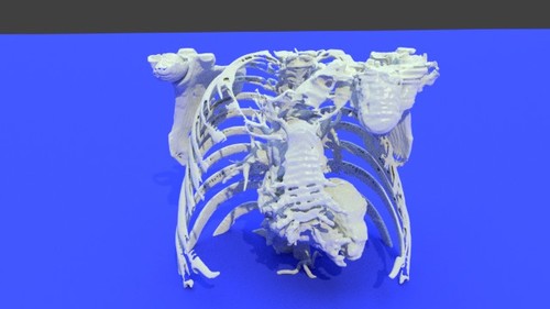 Compilation of Chest CT Scans - stl file processed - Thorax and Ribs ...