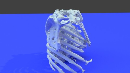 Compilation of Chest CT Scans - stl file processed - Thorax and Ribs ...