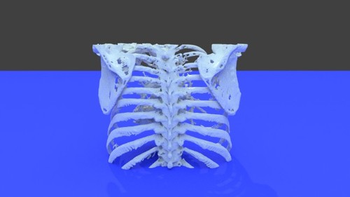 Compilation of Chest CT Scans - stl file processed - Thorax and Ribs ...