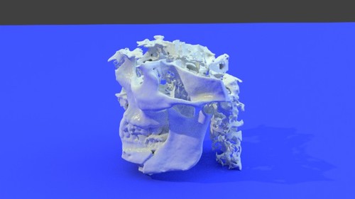 GSW to the face - stl file processed - Dental, Orthodontic ...