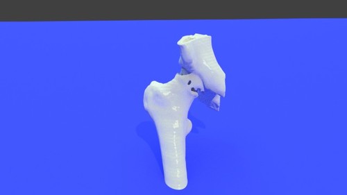 Right Hip Joint 3D Printable STL File Converted From CT Scan ...