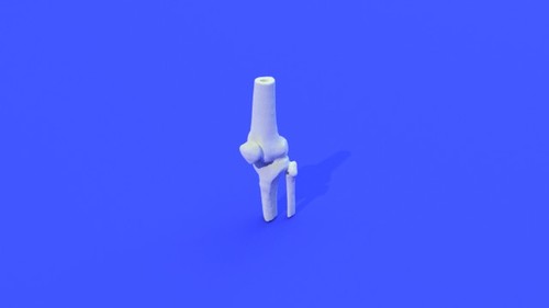 Left Knee Joint 3D Printable STL File Converted From CT Scan ...