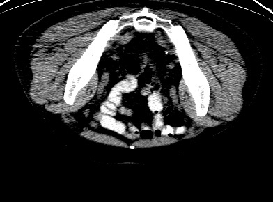 Whole Body - CT scan - Whole Body CTs - embodi3D.com