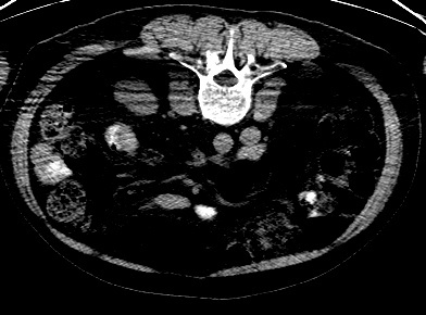Whole Body - CT scan - Whole Body CTs - embodi3D.com