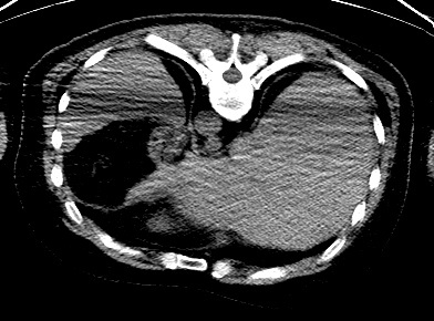 Whole Body - CT scan - Whole Body CTs - embodi3D.com