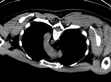 Whole Body - CT scan - Whole Body CTs - embodi3D.com