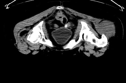 Whole Body - CT scan - Whole Body CTs - embodi3D.com