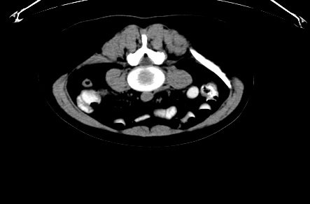 Whole Body - CT scan - Whole Body CTs - embodi3D.com