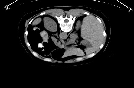 Whole Body - CT scan - Whole Body CTs - embodi3D.com