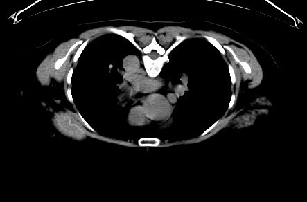 Whole Body - CT scan - Whole Body CTs - embodi3D.com