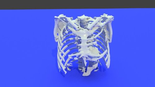 Chest wall - Bone model STL file from converted CT scan - Thorax and ...